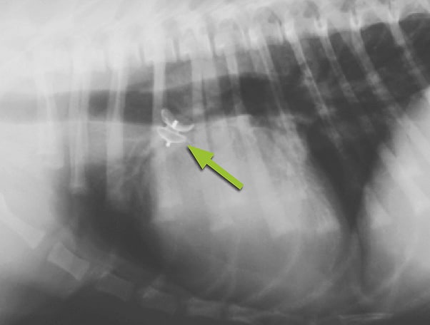 Patent Ductus Arteriosus (PDA) - NDSR