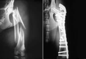 Fracture Treatment in Dogs and Cats Information Sheet | NDSR