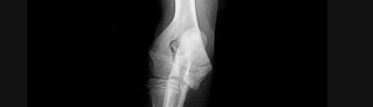 Humeral Condylar Fissures in Dogs (IOHC) | NDSR