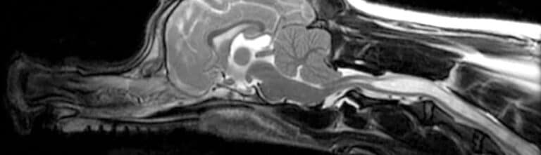 Syringomyelia - NDSR