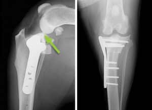 TPLO surgery for cruciate ligament rupture - NDSR
