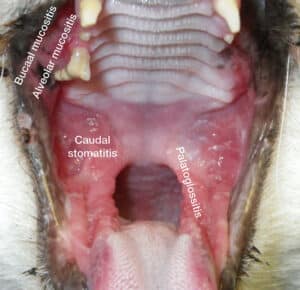 Gingivitis or Gingivostomatitis - what’s the difference? - NDSR