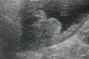 Lower Urinary Tract Neoplasia in Dogs - NDSR