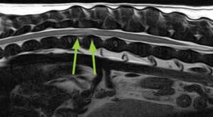 Intervertebral Disc Disease - NDSR