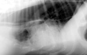 Neuromuscular Disease - NDSR