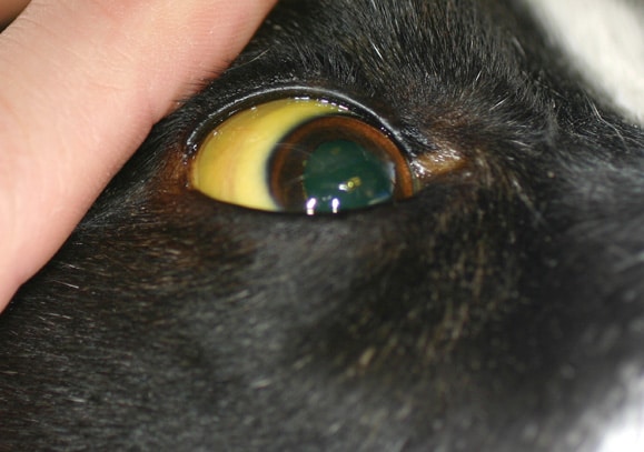 Acute liver failure | NDSR