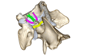 Canine Atlantoaxial Instability - NDSR