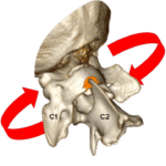 Canine Atlantoaxial Instability - NDSR