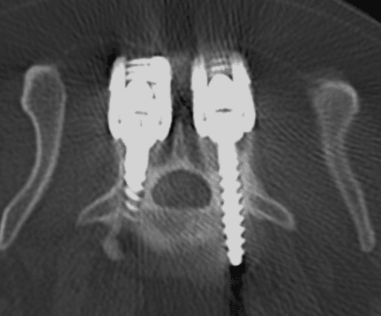 Pioneering Spinal Care Transforming Lives - NDSR